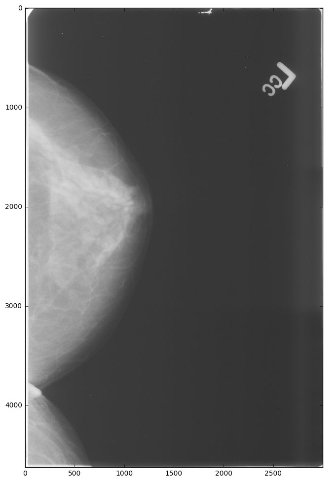 Open-Sourcing breast_segment - Oliver Eidel's Blog